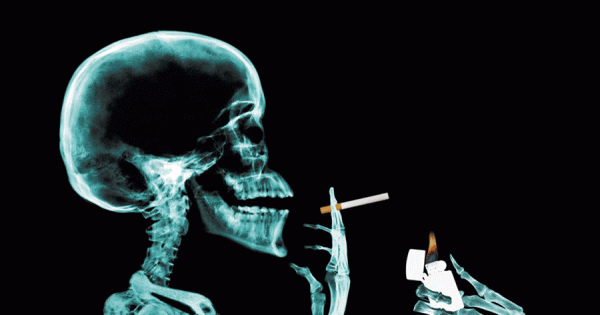 Vertical » Spune stop fumatului! Cancerul ucide indiferent de vârstă